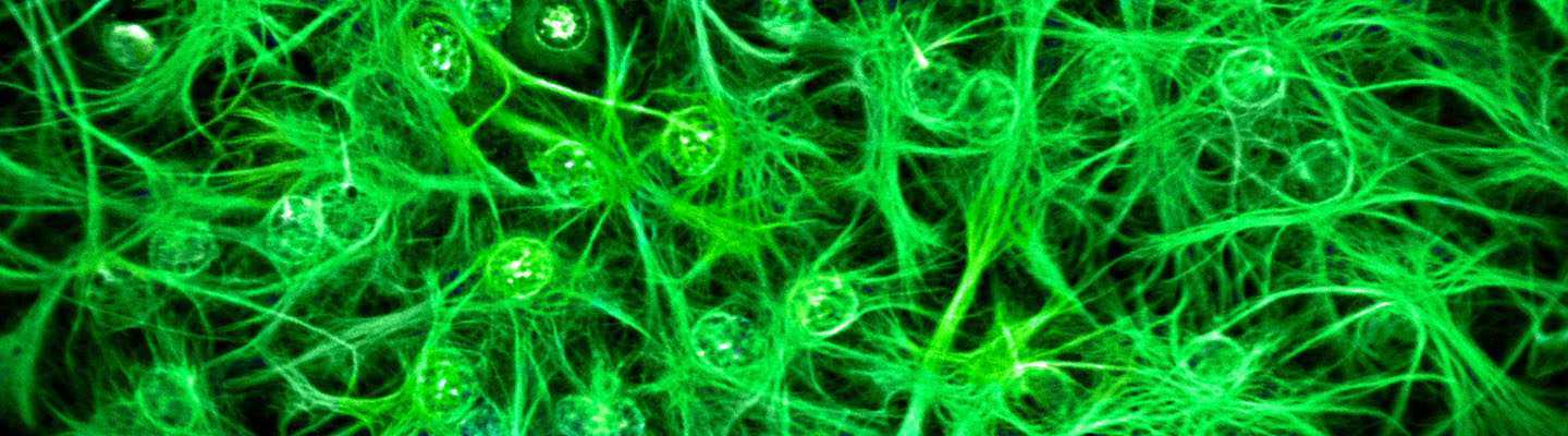 Home: Northwestern University Interdepartmental Neuroscience: Feinberg ...